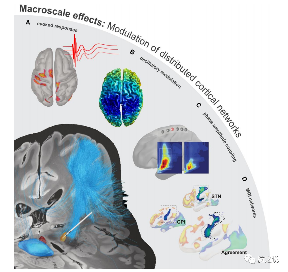 Brain综述：跨时空分辨率的DBS神经生理机制_brain综述:跨时空分辨率的dbs神经生理机制-CSDN博客