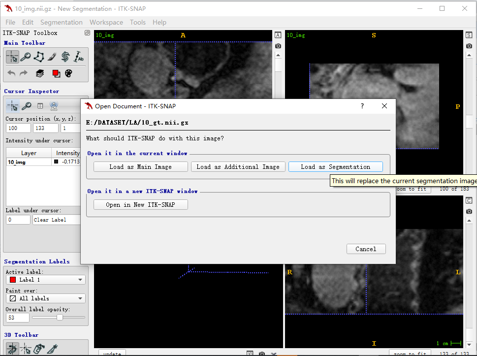 ITK-SNAP基础教程_itk snap-CSDN博客