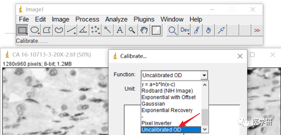 imagej得到灰度图数据_轻松学会用Image J定量分析免疫组化图_瑾欢的博客-CSDN博客
