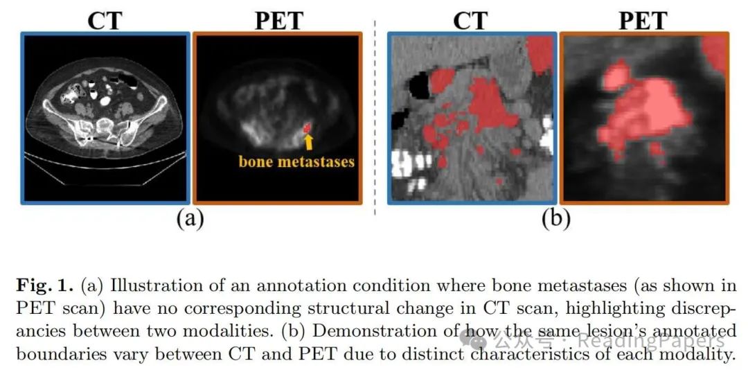 医图顶会 MICCAI‘24 | LM-UNet: 用于全身CT分割的双模态注释的Mamba U-Net网络_lm-unet: whole-body pet-ct lesion ...