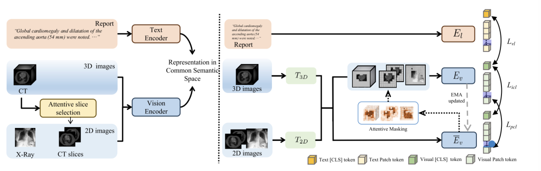 ECCV 2024 | 浙大和微软提出UniMedI：统一医学图像预训练框架-CSDN博客