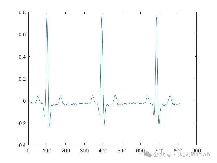 【心电信号 】ECG心电信号QRS波群特征提取附Matlab代码_matlab心电信号特征处理-CSDN博客