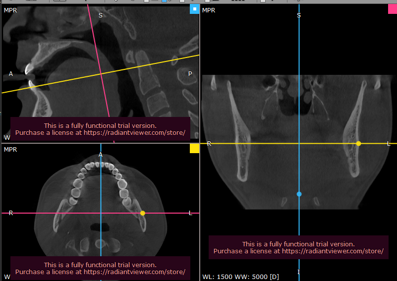 VTK MPR 每张图对应空间位置提示_基于vtk的mpr实现-CSDN博客