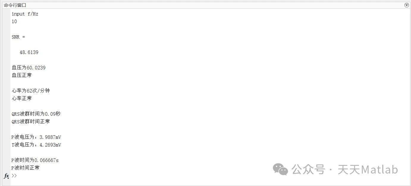 【心电信号 】ECG心电信号QRS波群特征提取附Matlab代码_matlab心电信号特征提取-CSDN博客